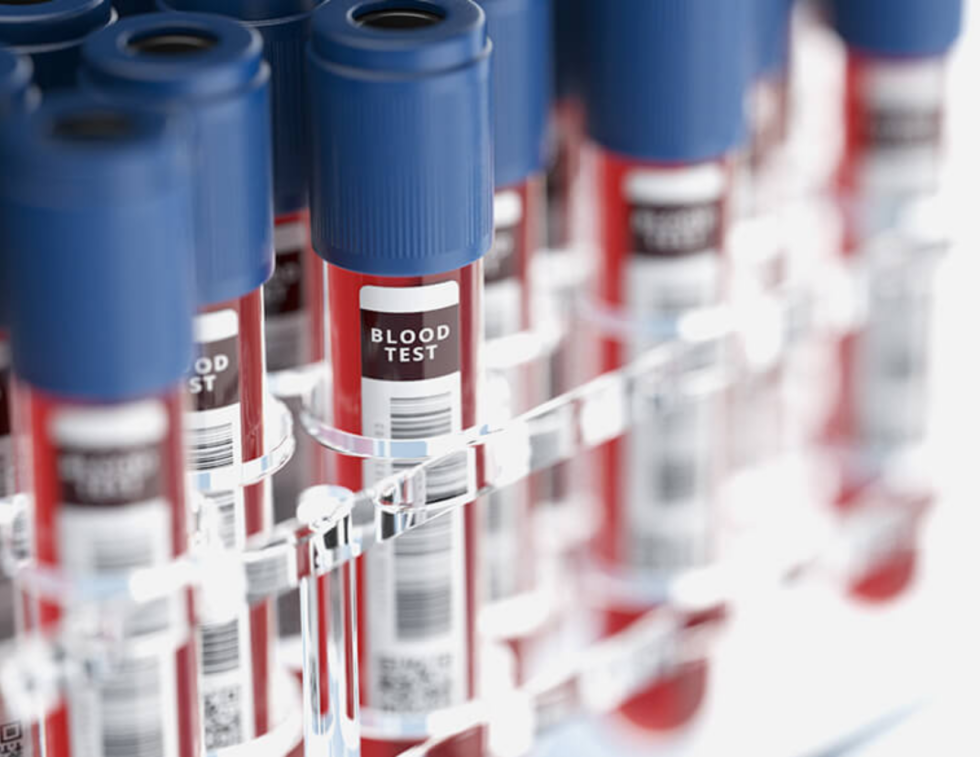 Diagnostic Testing | Madison Core Labs | Huntsville, AL